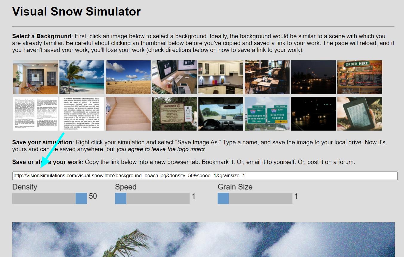 ビジュアルスノウ（視界砂嵐症候群）の見え方を他人に伝えられるシュミレーター｜ビジュアルスノウ広報